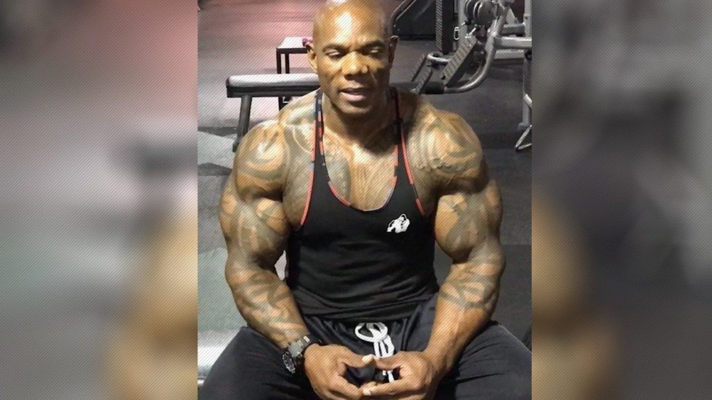 Flex Wheeler had to have part of his right leg amputated ...