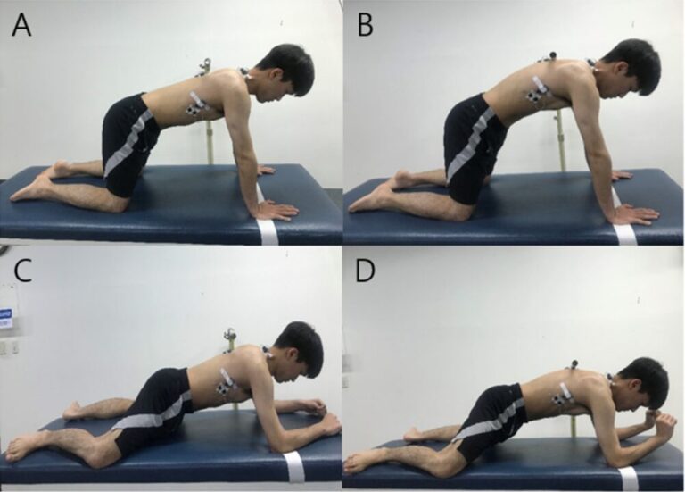 Scapular Stabilization Exercises Physical Therapists Recommend ...